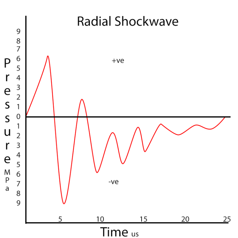 Shockwave Theory – Shockwave Therapy